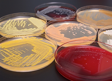 Bioburden Testing and Microorganism Characterization Webinar