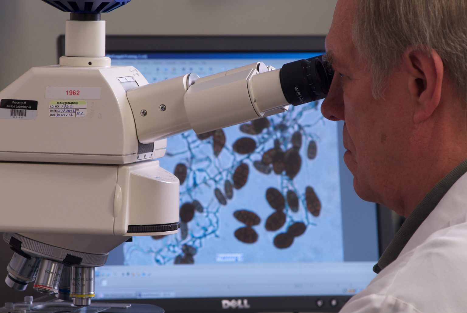 Microbial Identification: Genetic Sequencing or MALDI-TOF?